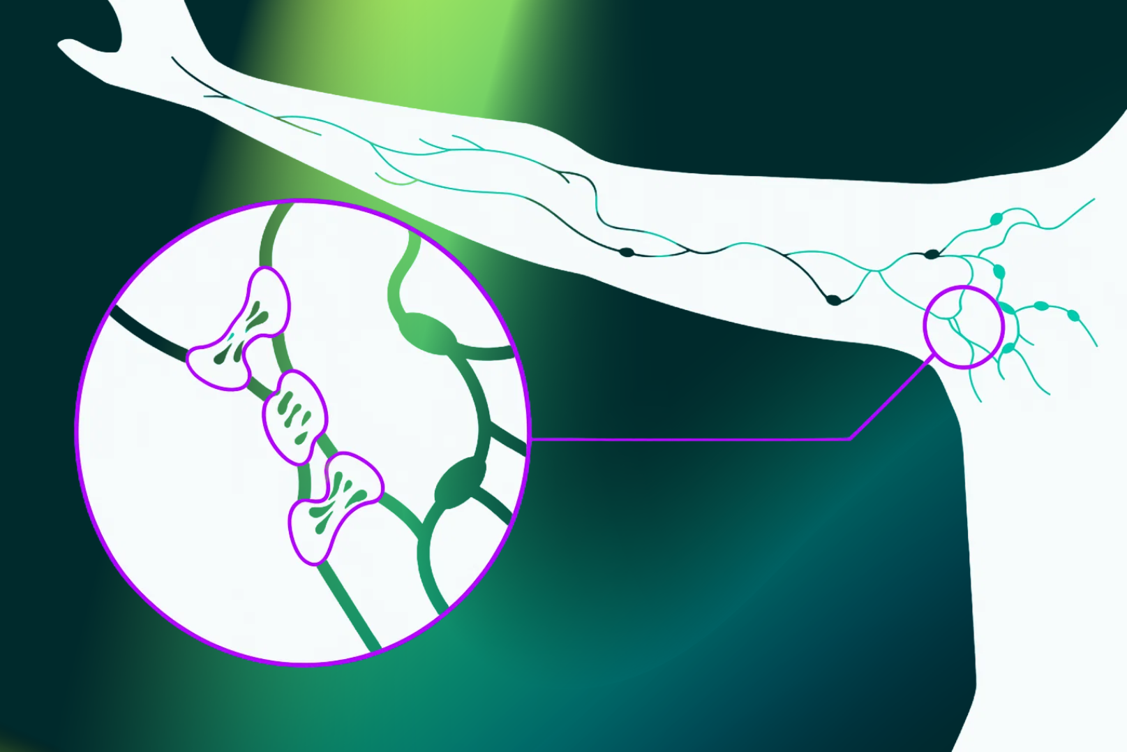 Axillary Cord Formation Also Known As Cording Or Axillary Syndrome